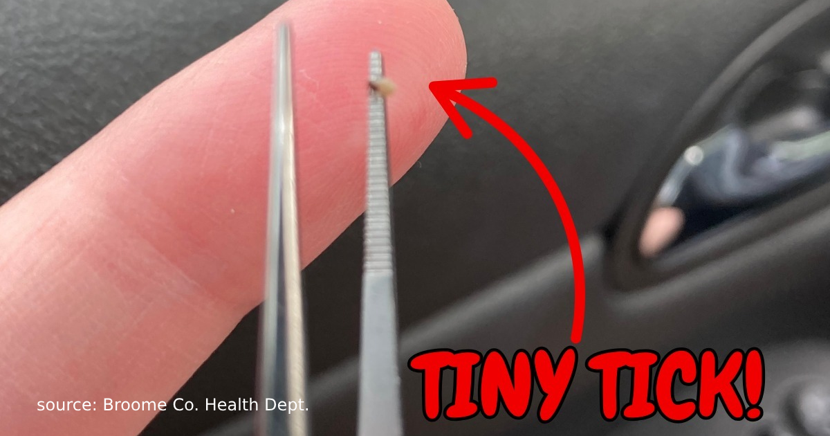 Broome Health Department Employee Finds Tiny Tick, Prompts Public ...
