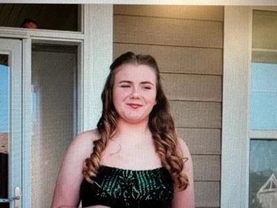 Minnesota teen suffers severe chemical burns in freak accident in ...