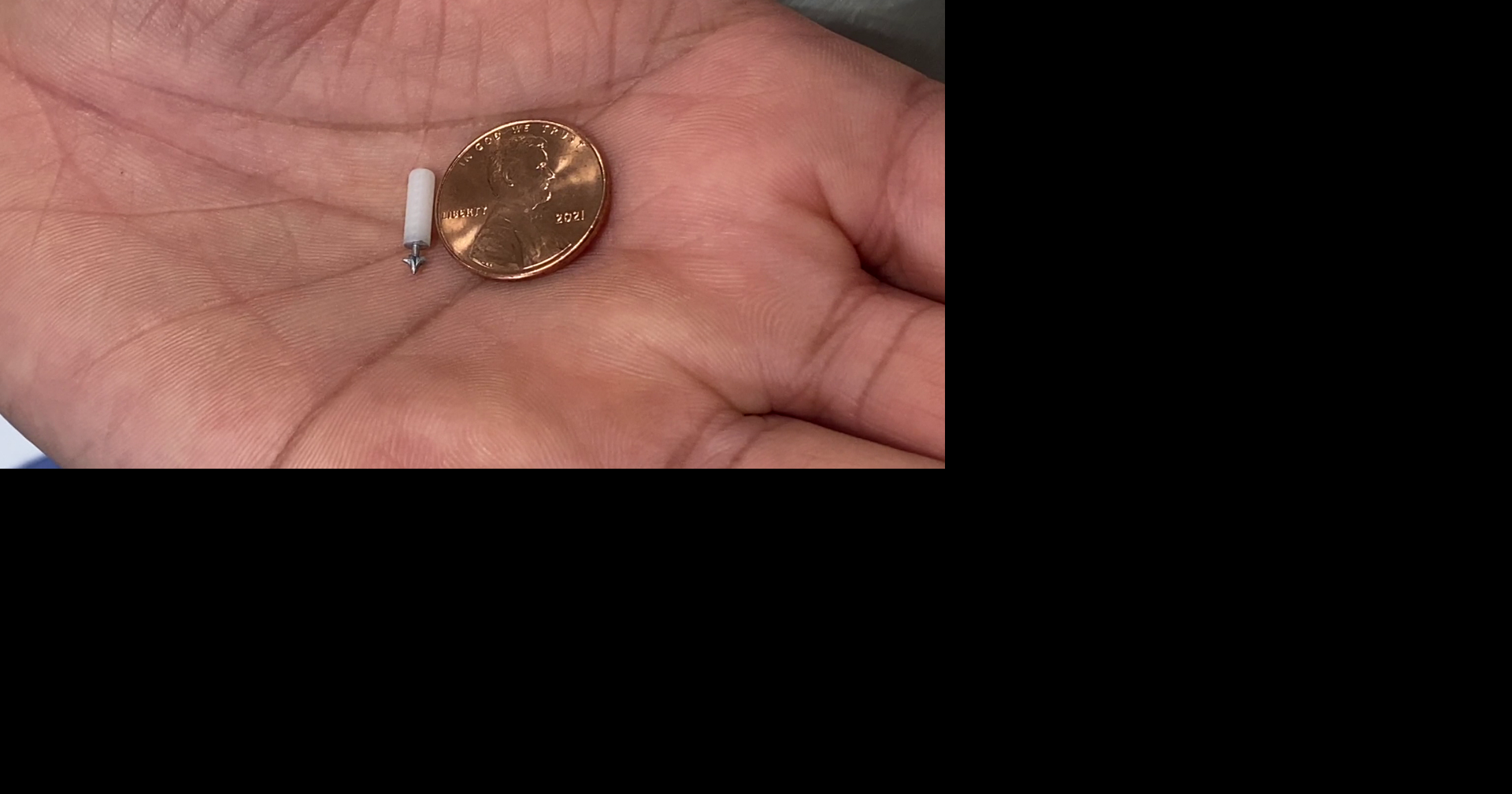 Wireless pacemaker transforms heart care | Health & Medical | winknews.com
