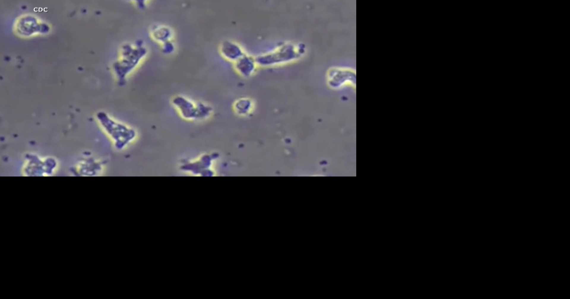 Questions mounting after brain-eating amoeba death in Charlotte County ...