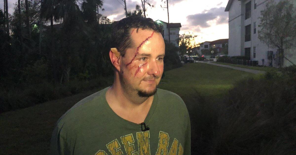 Bear injures man outside Naples home, neighbors on alert | Collier ...