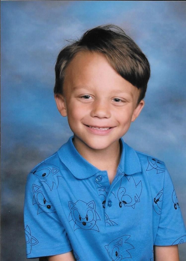 Wisconsin boy recovering after vicious dog attack