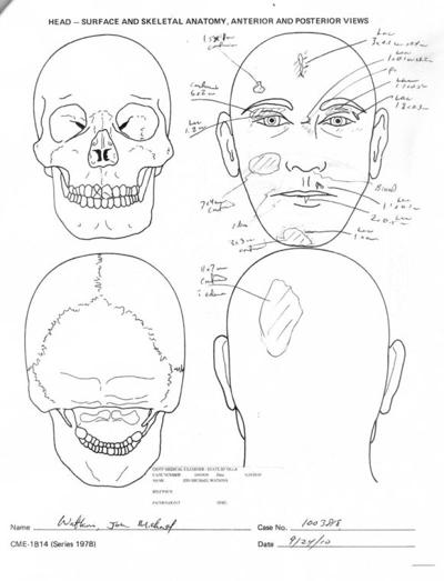 Autopsy reveals 20-year-old man suffered multiple contusions to head ...