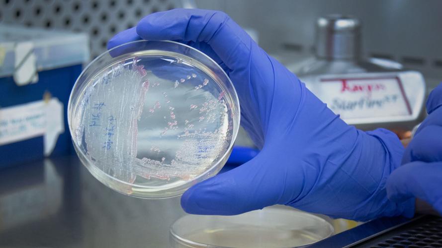 WVU researchers testing antibody to treat drug-resistant bacteria ...