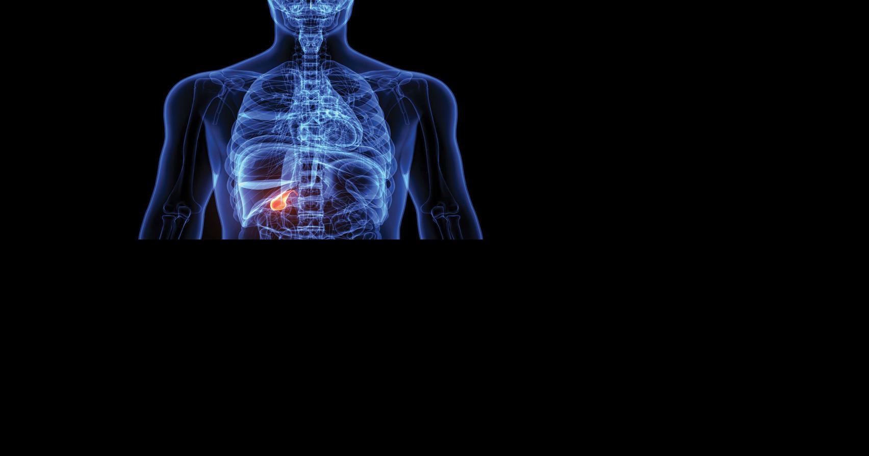 EDGE procedure gives options to gastric bypass patients | WVU Medicine ...