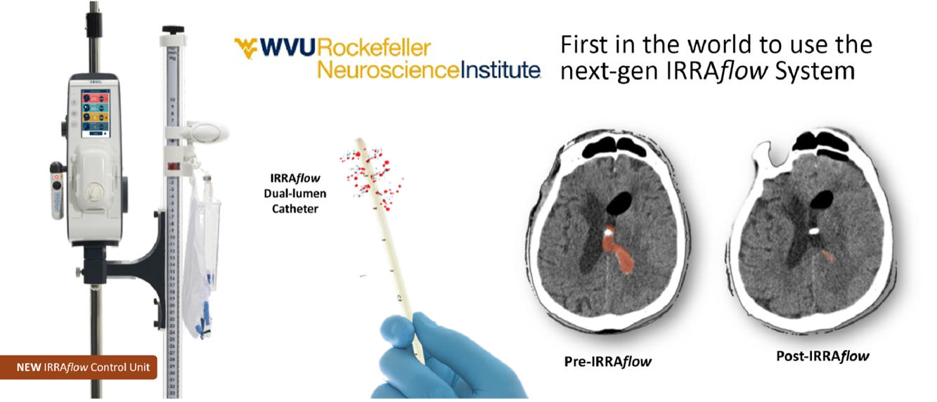 WVU Rockefeller Neuroscience Institute neurosurgeon first in the world ...