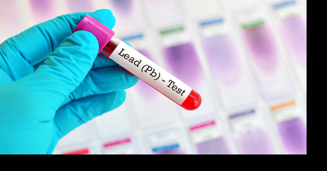 LECOM students provide free lead screenings for children | Local ...