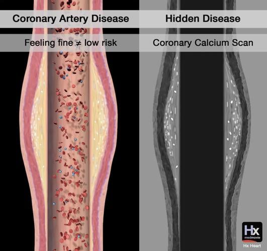 Medmovie's Hx Heart Video Library Powers Patient Education at ...