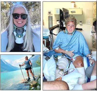 Falling down and bouncing back: Karen’s story | Local News ...
