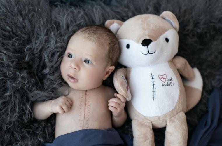 Heart warrior: Infant survives 10-hour open heart surgery thanks to ...