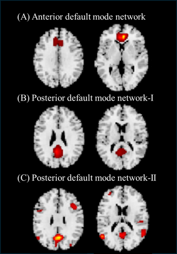 Study finds vitamin C boosts brain health in older adults | Health ...