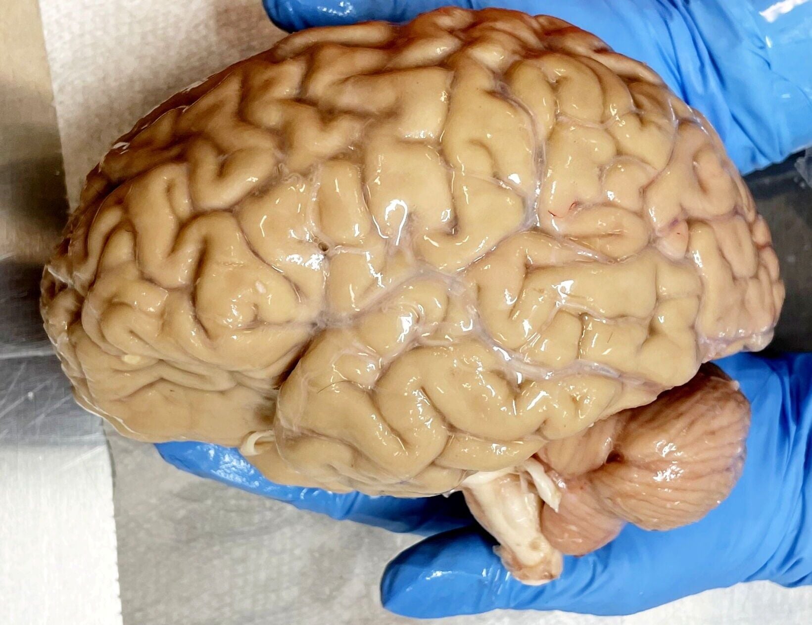 Would deep freezing humans like in sci-fi actually work? | Health ...