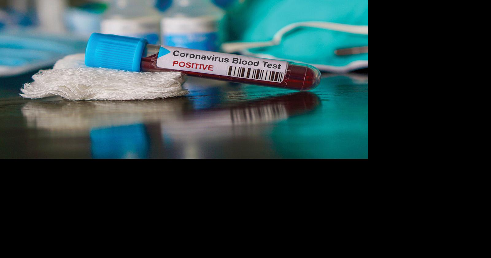 COVID-19 Case Confirmed At Vermillion Golf Course | Community | yankton.net