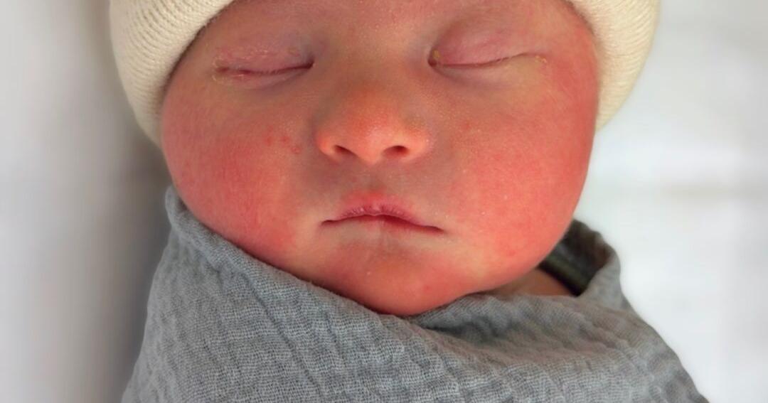 Harvey James Stork