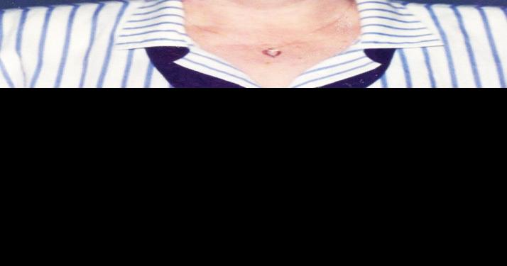 Death, Sharon Ellison