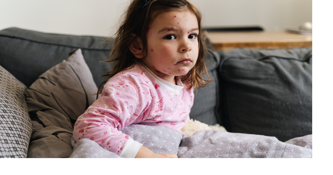 Measles Resurgence: Sharp rise in U.S. cases sparks public health alarm ...