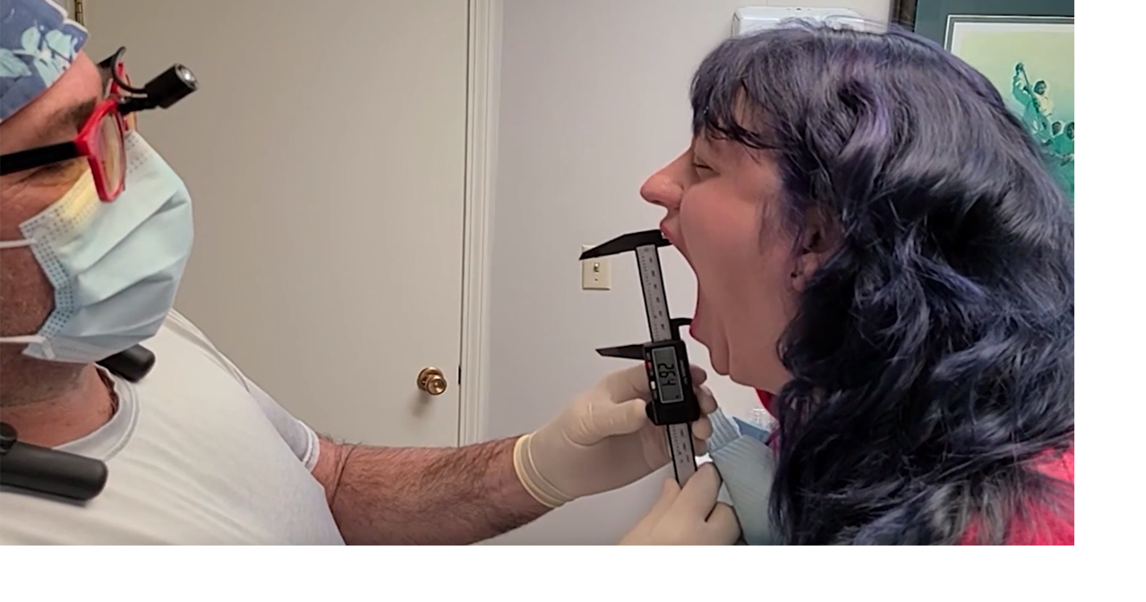 Marie Robinson of Ketchikan sets Guinness World Record for mouth gape ...